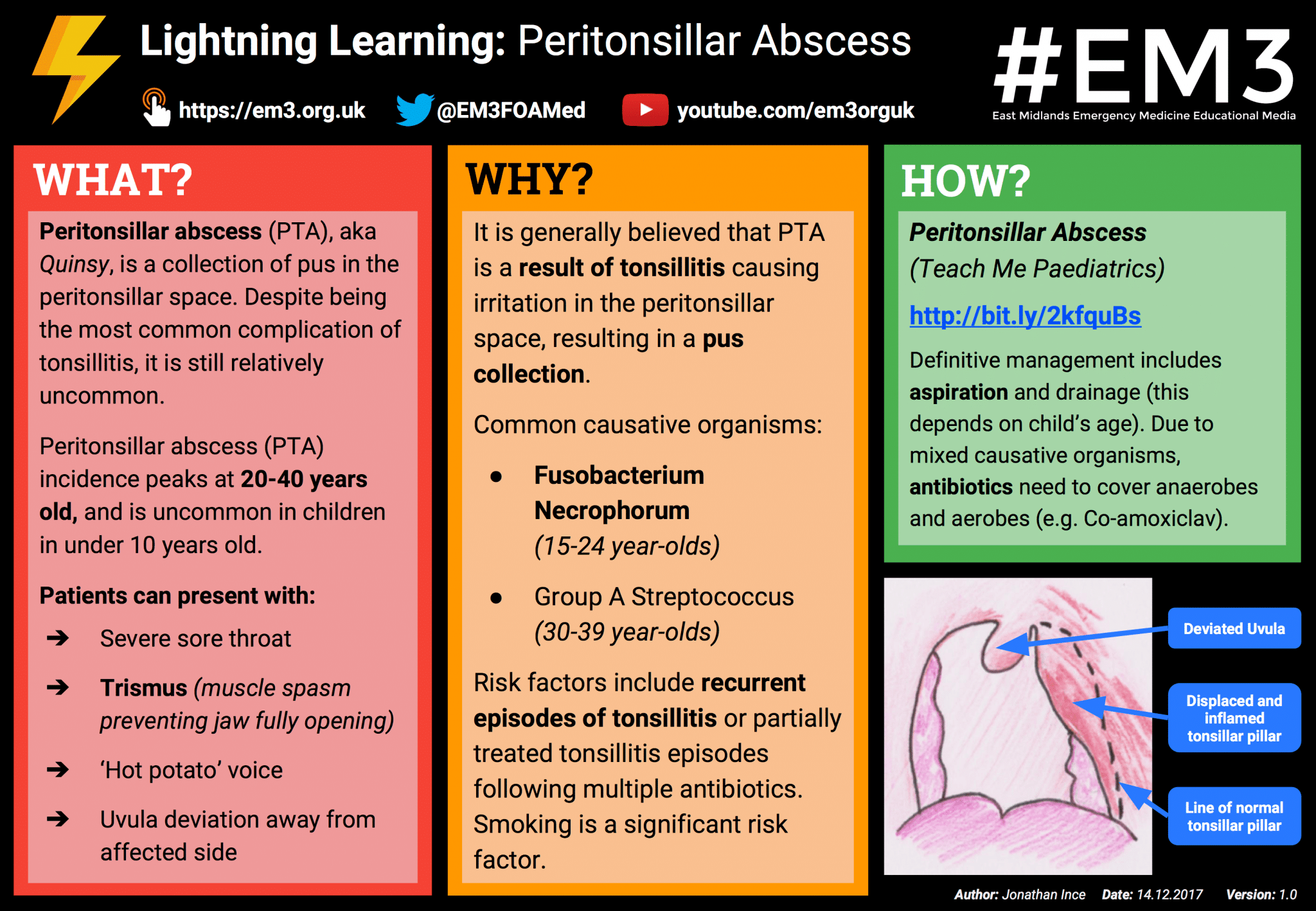 Peritonsillar abscess - Management - TeachMePaediatrics