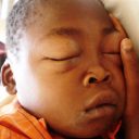 Nephrotic syndrome - Differential Diagnosis - Management ...