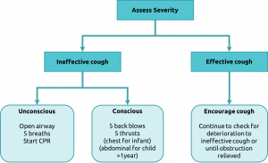 Choking - Risk factors - Management - TeachMePaediatrics