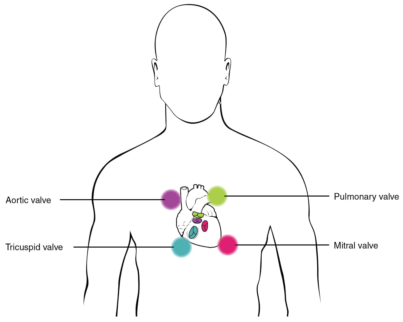 Atrial Septal Defect TeachMePaediatrics