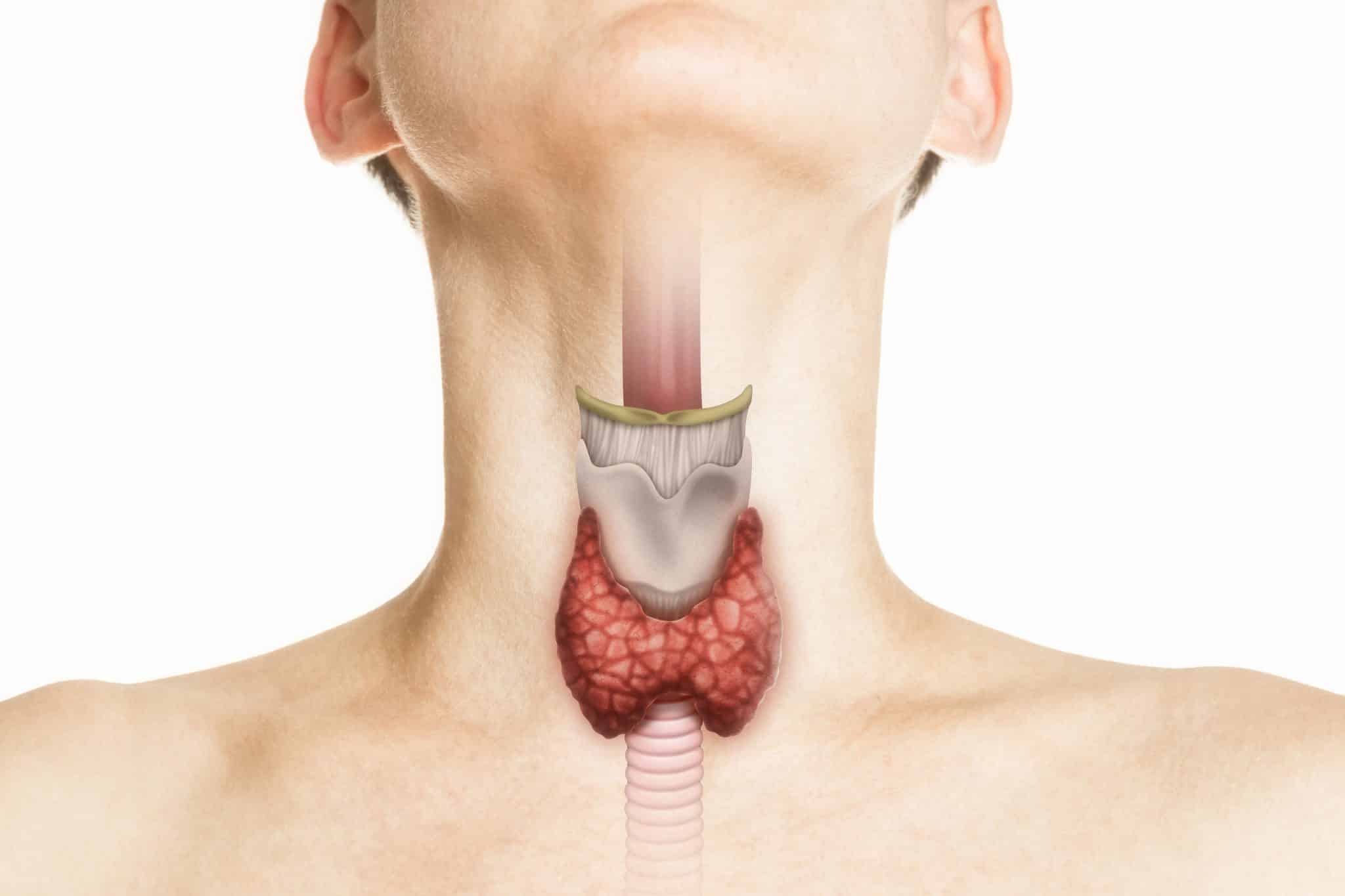 Hyperthyroidism - TeachMePaediatrics