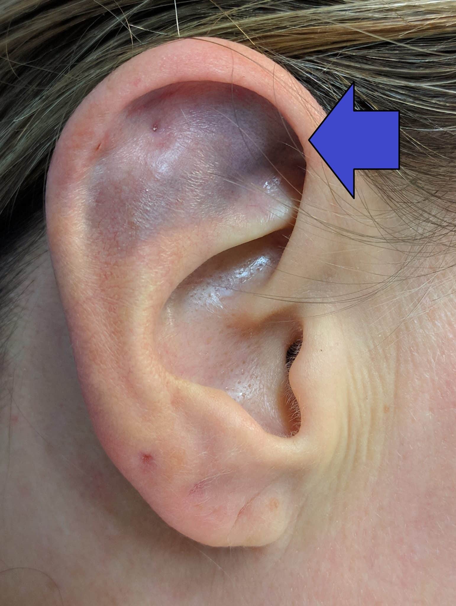Ear - TeachMePaediatrics