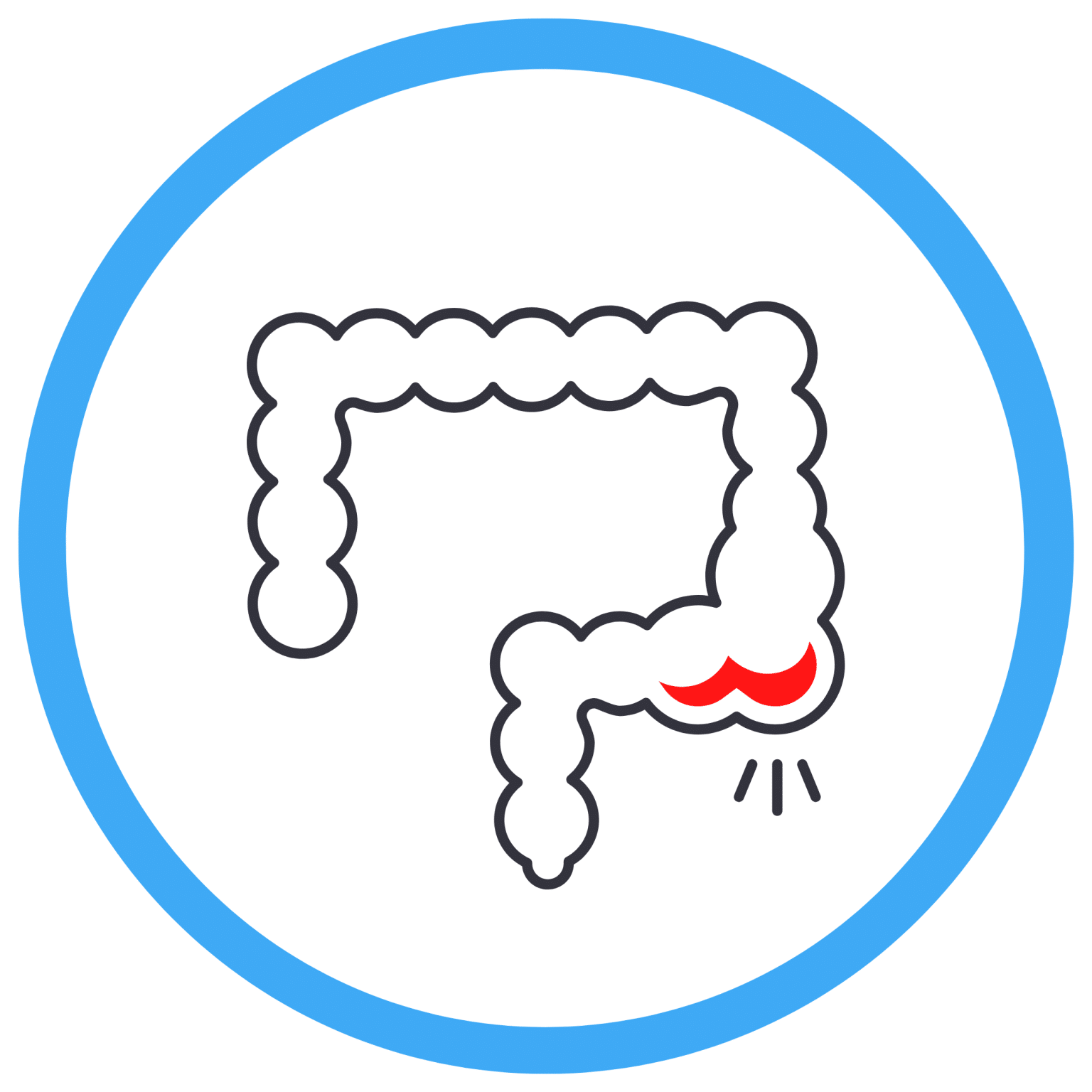 Lower GI - TeachMePaediatrics